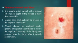1. WOUND & WOUND HEALING III BHMS SURGERY.ppsx