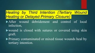 1. WOUND & WOUND HEALING III BHMS SURGERY.ppsx
