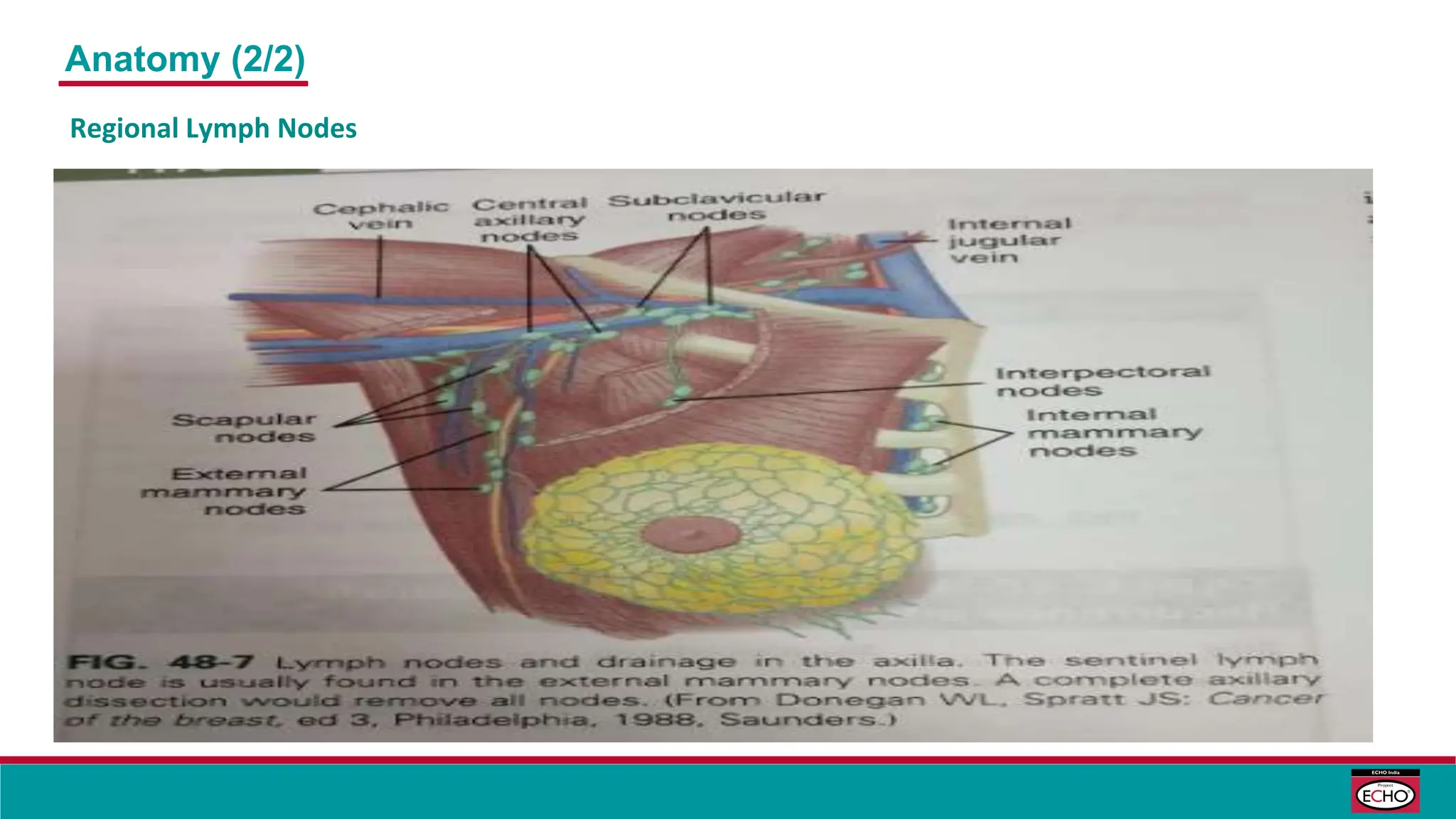 Breast Cancer- introduction, patho,signs-sympt.pptx