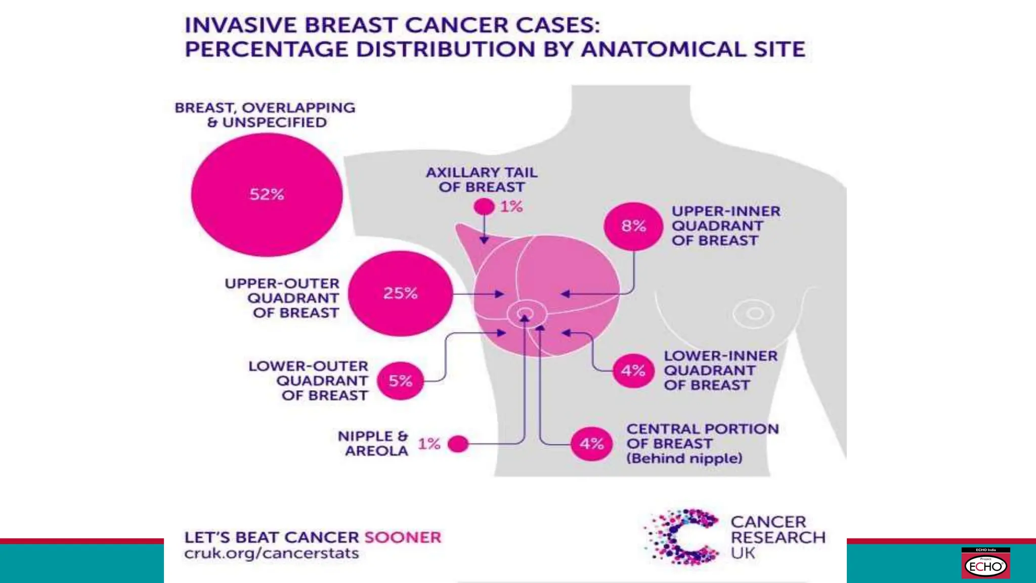 Breast Cancer- introduction, patho,signs-sympt.pptx