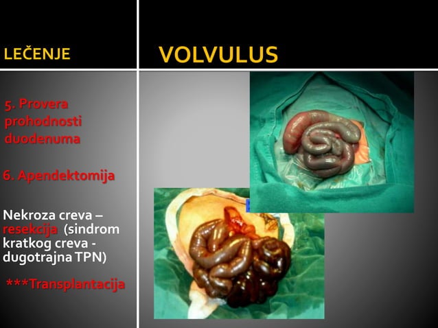 1.-Volvuluv prezentacija za studente-VOLVULUS.pptx