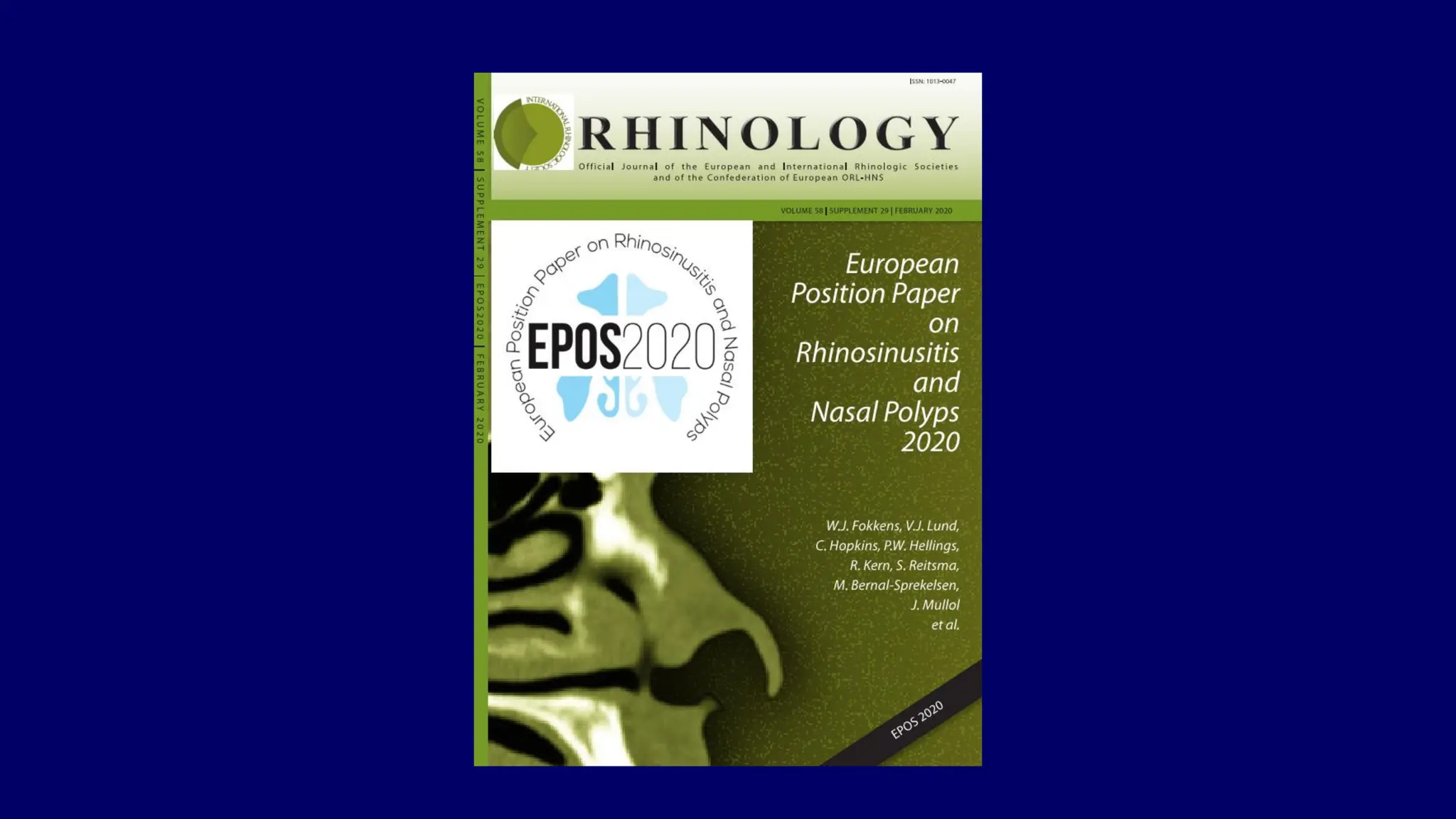 Cập nhật chẩn đoán và điều trị viêm xoang EPOS.pdf