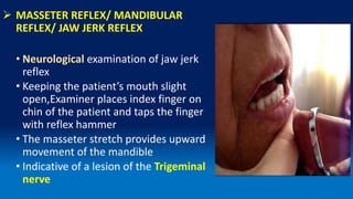 1. MUSCLES OF MASTICATION Described in detail .pptx