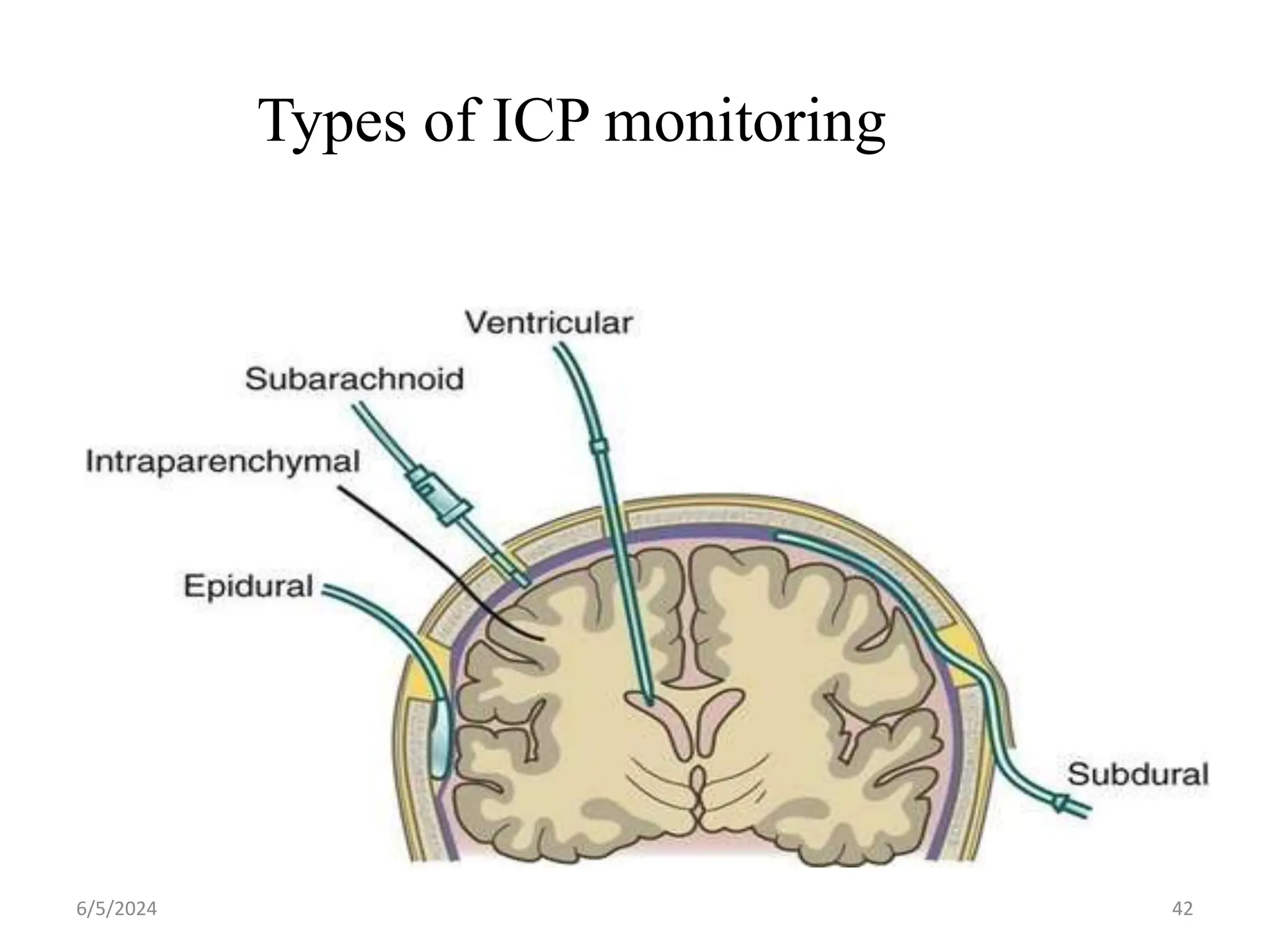 1.Invasive_Monitoringin ICU SHB-F resident.pptx