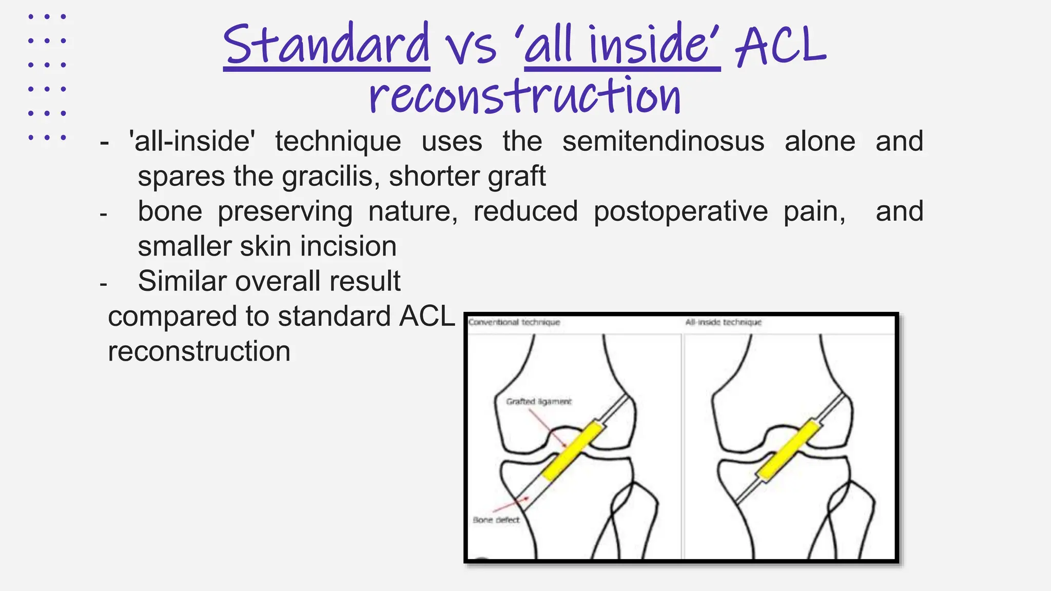 1.Update on ACL injuries and management NOOR AZMI MN (2).pptx | Death ...