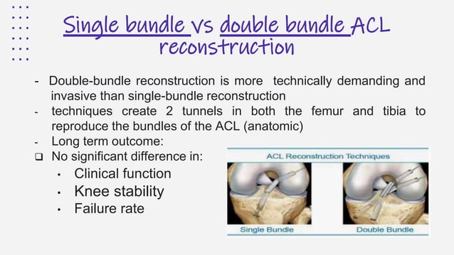 1.Update on ACL injuries and management NOOR AZMI MN (2).pptx | Death ...
