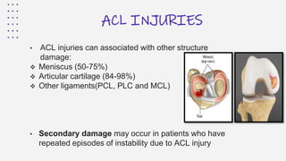 1.Update on ACL injuries and management NOOR AZMI MN (2).pptx