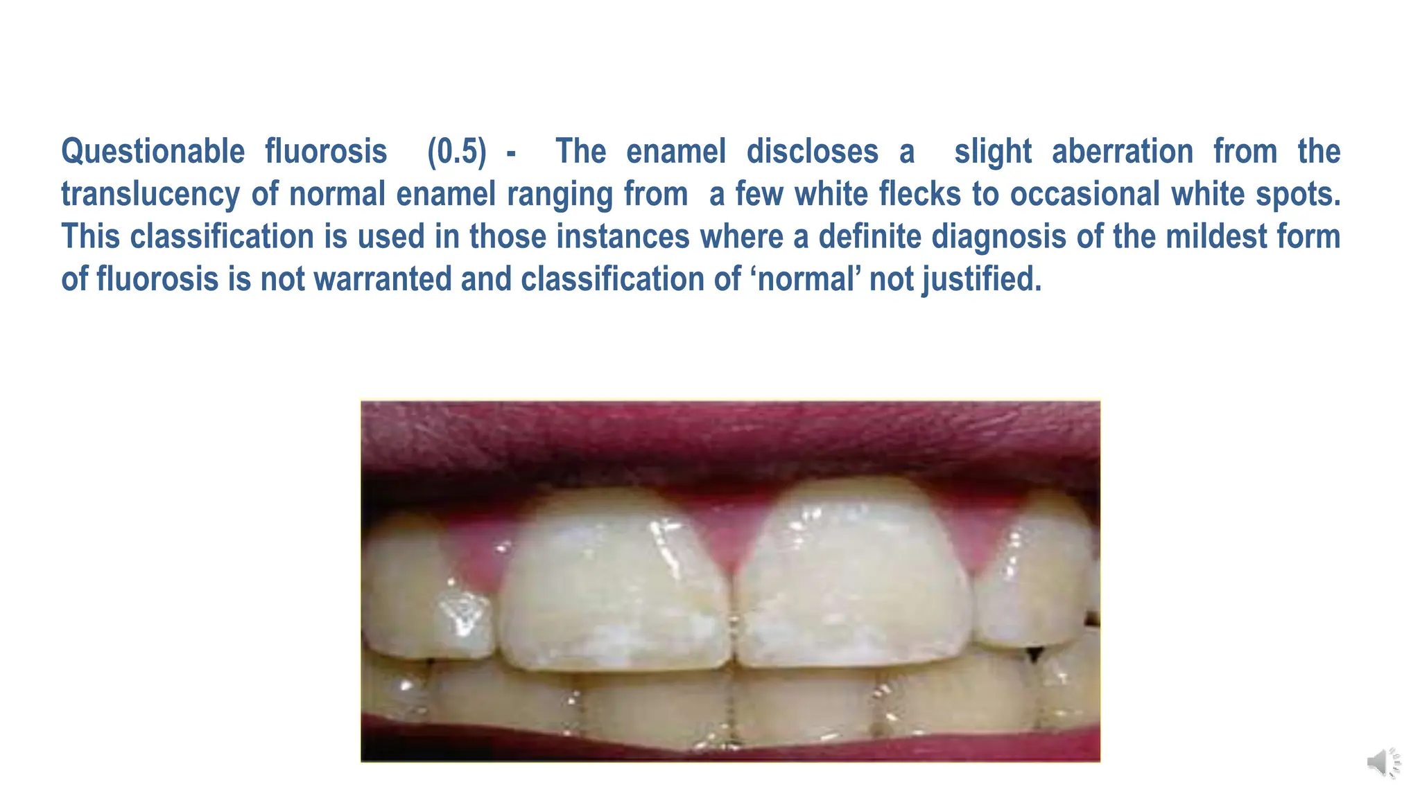 Deans Fluorosis Index powerpoint presentation | PPTX