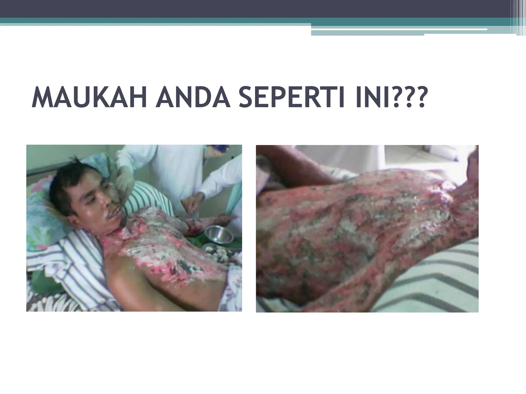 Dasar-Dasar Keselamatan Kesehatan Kerja NPM.ppt