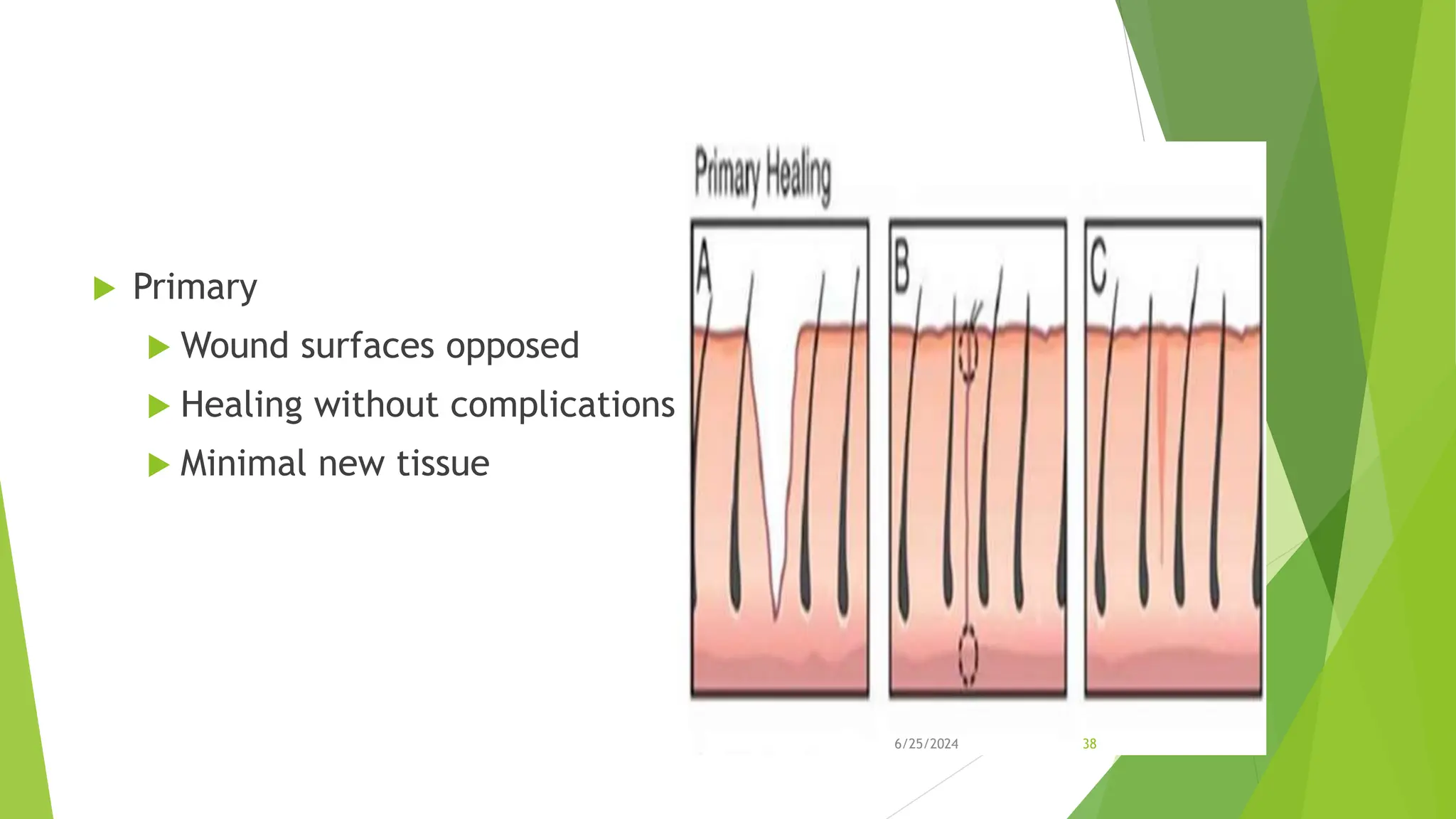 1.Wound healing 2.pptxon the surgical point | PPT