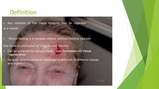 1.Wound healing 2.pptxon the surgical point | PPTX