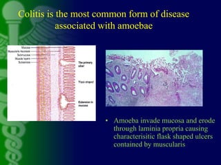 amebic & other protozoals AND DRUGS FOR AMOEBIASIS | PPT