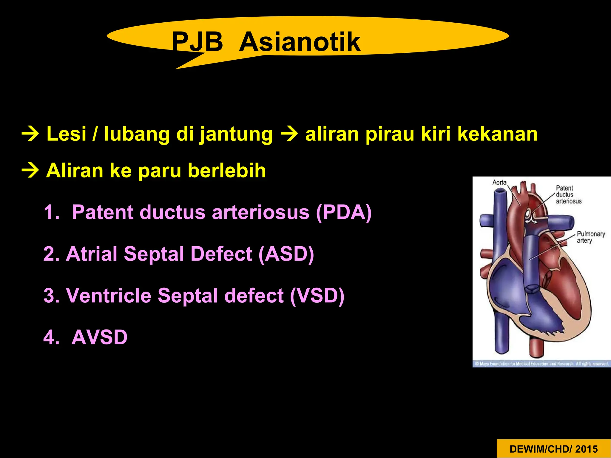 penyakit jantung bawaan, TGA TOF1234567899 | PDF