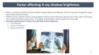 1. Introduction to basic of chest x-ray.PDF
