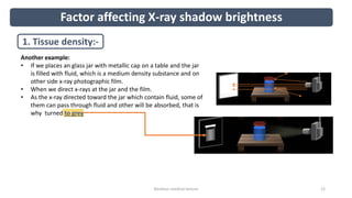 1. Introduction to basic of chest x-ray.PDF