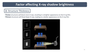 1. Introduction to basic of chest x-ray.PDF