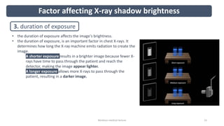 1. Introduction to basic of chest x-ray.PDF