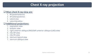 1. Introduction to basic of chest x-ray.PDF
