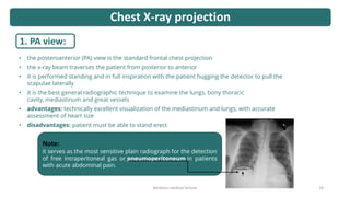 1. Introduction to basic of chest x-ray.PDF