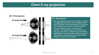 1. Introduction to basic of chest x-ray.PDF