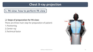1. Introduction to basic of chest x-ray.PDF