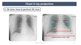 1. Introduction to basic of chest x-ray.PDF