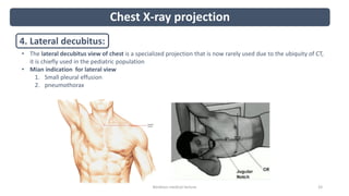1. Introduction to basic of chest x-ray.PDF