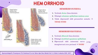 1. Hemoroid hemroud hemoroid hemoroid hemor | PPTX