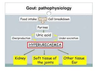1.Diseases of Bones nad joints Pathophysiology(RA Gout).pptx