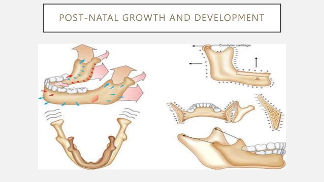 growth and development of mandible both prenatal and postnatal | PPT