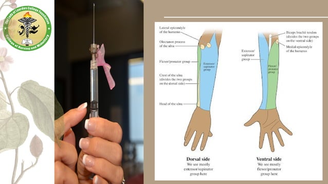 Intradermal - Parenteral Administrations | PPT