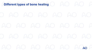 1.1 AO course 2024 Biology of bone healing.pdf