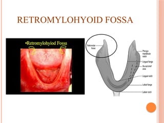 1. ANATOMICAL LANDMARKS OF MANDIBLE.pptx