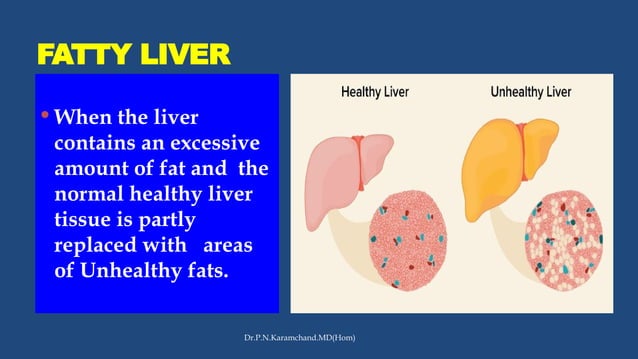 1. What is FATTY LIVER Liver Disease? FLD | PPTX | Endocrine and ...