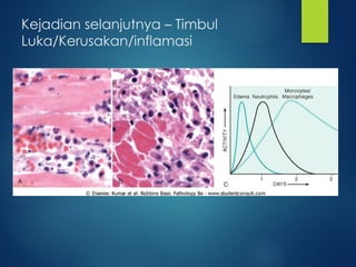 Patofisiologi Inflamasi_Inflamasi dan Penyembuhan Luka (Wound Healing ...