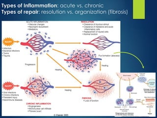 Patofisiologi Inflamasi_Inflamasi dan Penyembuhan Luka (Wound Healing ...