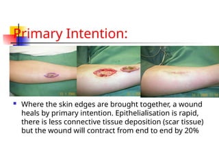 1. Wound management Wound management.ppt