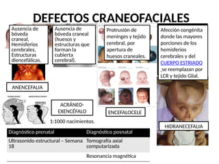 1. NEUROANATOMIA MALFORMACIONES CRANEOFACIALES.pptx