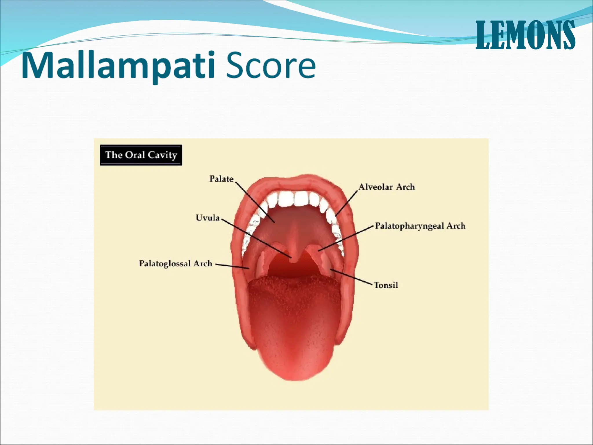 1.AIRWAY ASSESSMENT LOOK, LISTEN, FEEL: Mallampati, LEMON, neck ...