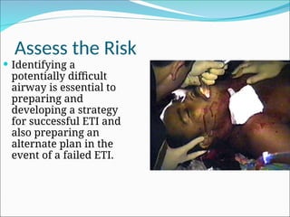 1.AIRWAY ASSESSMENT LOOK, LISTEN, FEEL: Mallampati, LEMON, neck ...