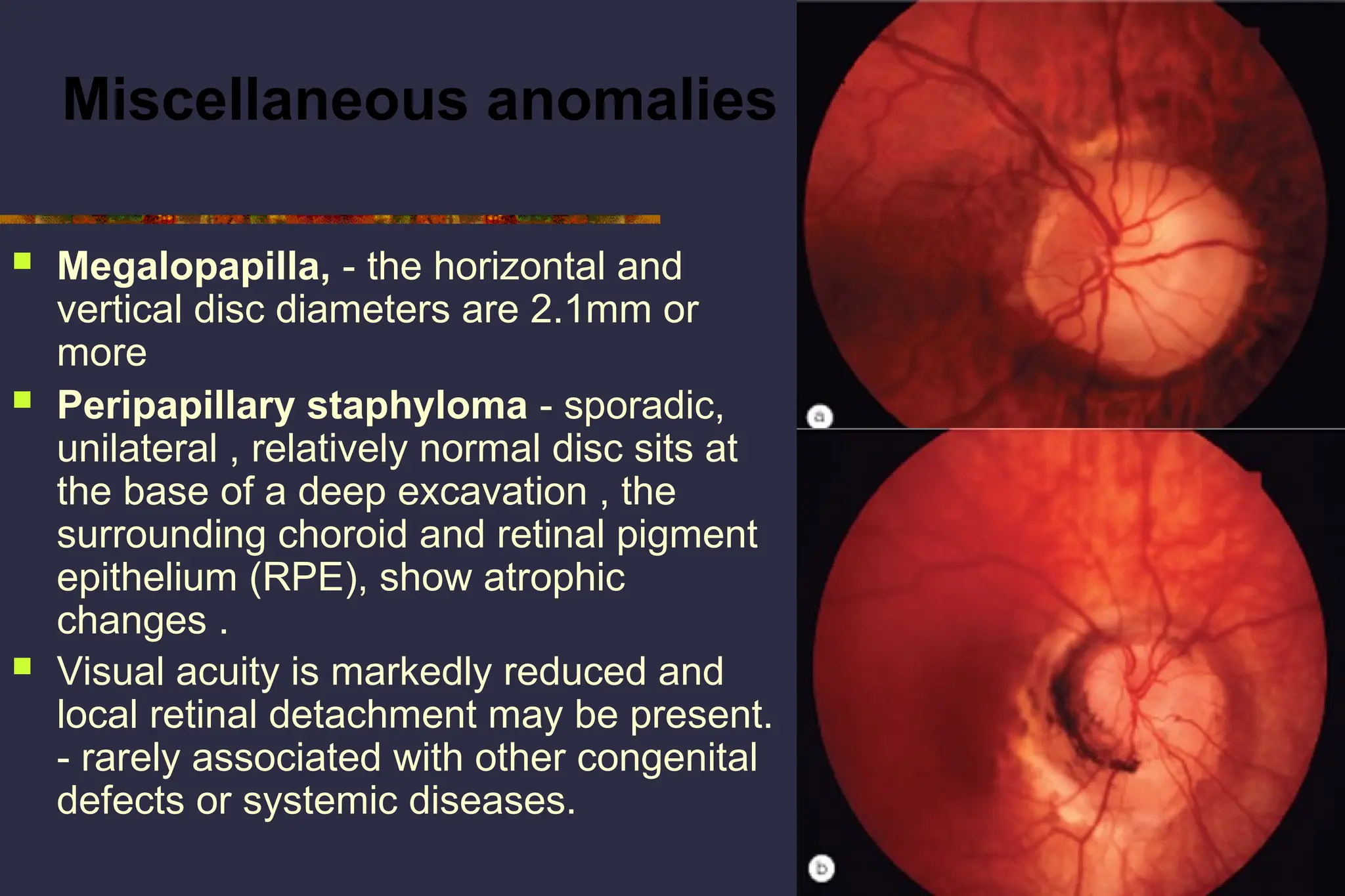 1. ON Anomalies.ppt for ophthalmology students | PPT