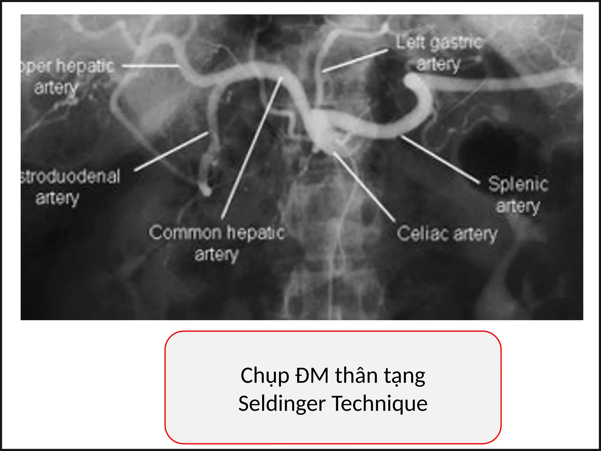 1. Dạ dày.pptx dạ dày dạ dày ddddddddddd | PPTX