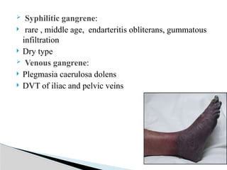 1.7.gangrene. Macroscopic death of tissue | PPTX
