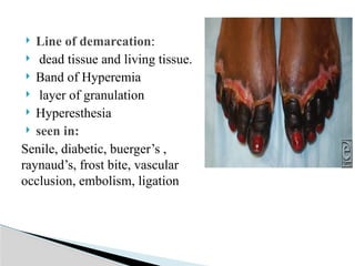 1.7.gangrene. Macroscopic death of tissue | PPTX
