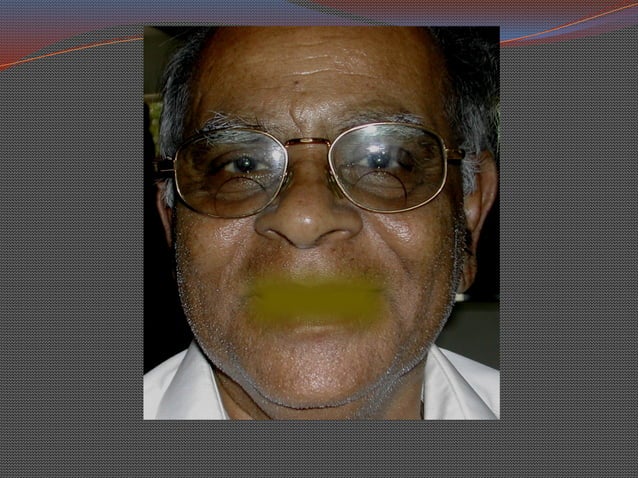 Complete denture Introduction .the way to get start | PPTX