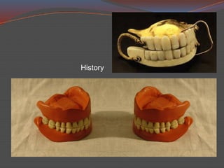 Complete denture Introduction .the way to get start | PPT