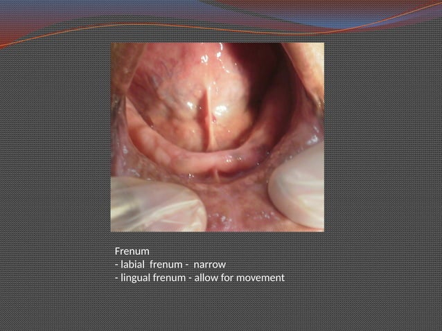 Complete denture Introduction .the way to get start | PPTX