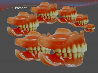 Complete denture Introduction .the way to get start | PPTX