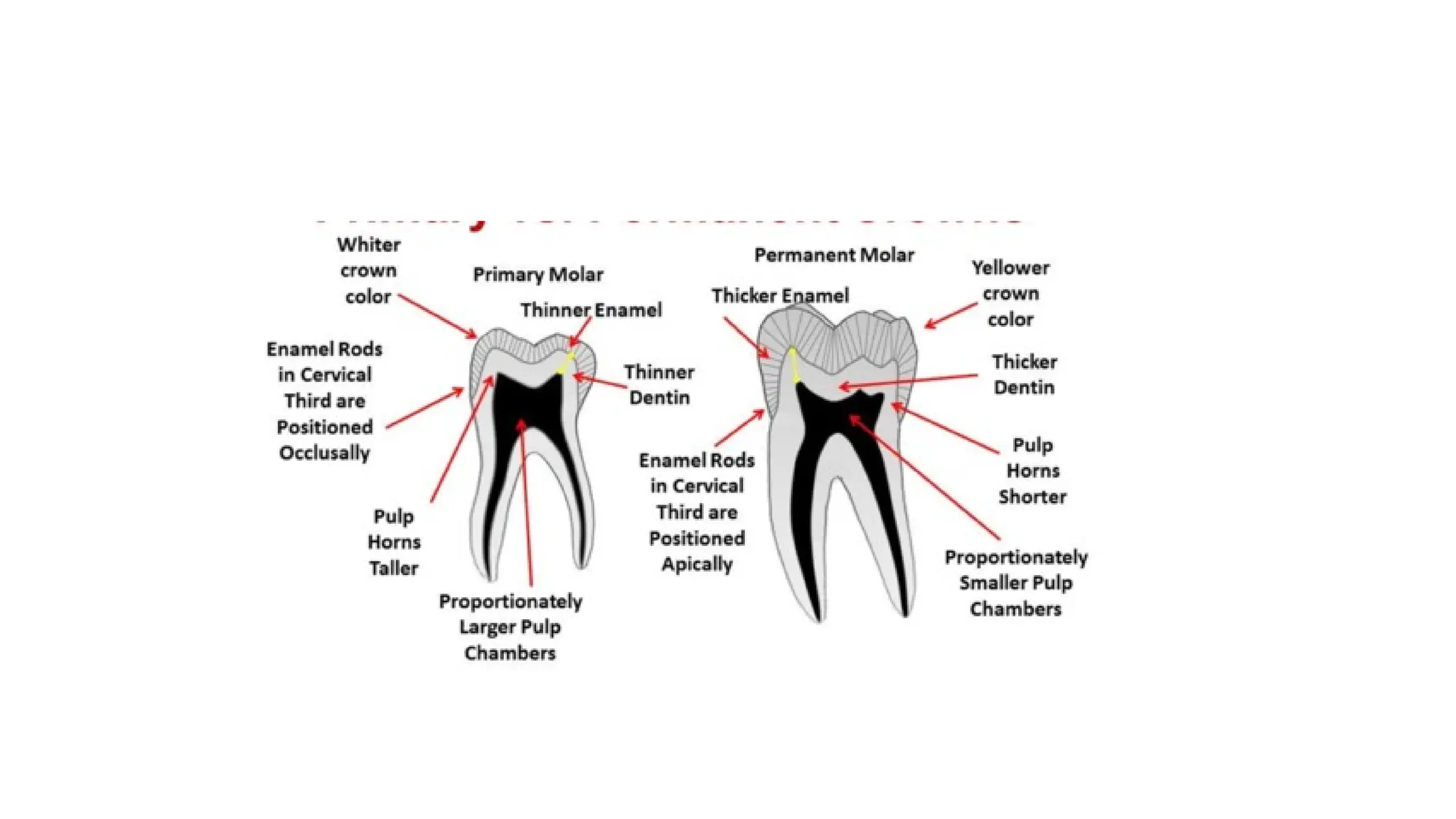 1. CLASS 1 CAVITY PREP.pptx conservative dentistry | PPTX