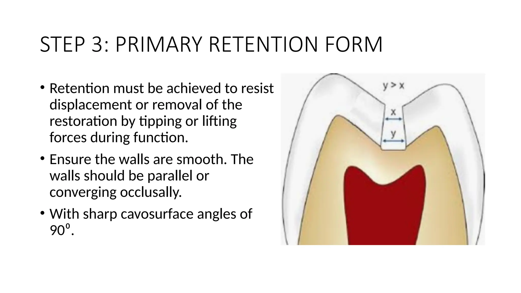 1. CLASS 1 CAVITY PREP.pptx conservative dentistry | PPTX